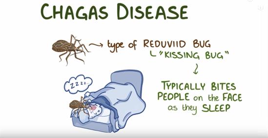 Chagas disease (American trypanosomiasis)