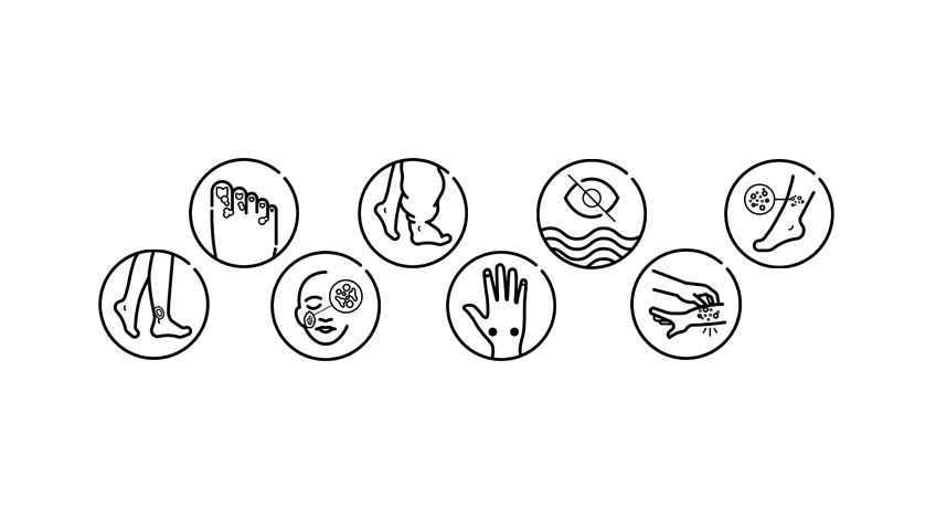 Control of Neglected Tropical Diseases