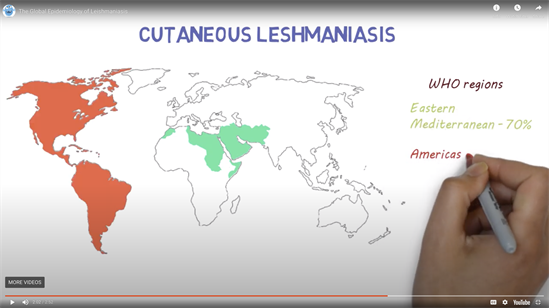 Leishmaniasis