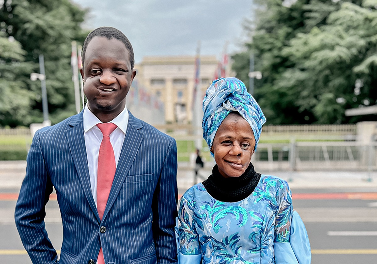 Surviving survival: the impact of noma