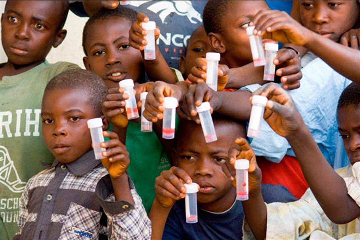 Schistosomiasis (bilharzia)