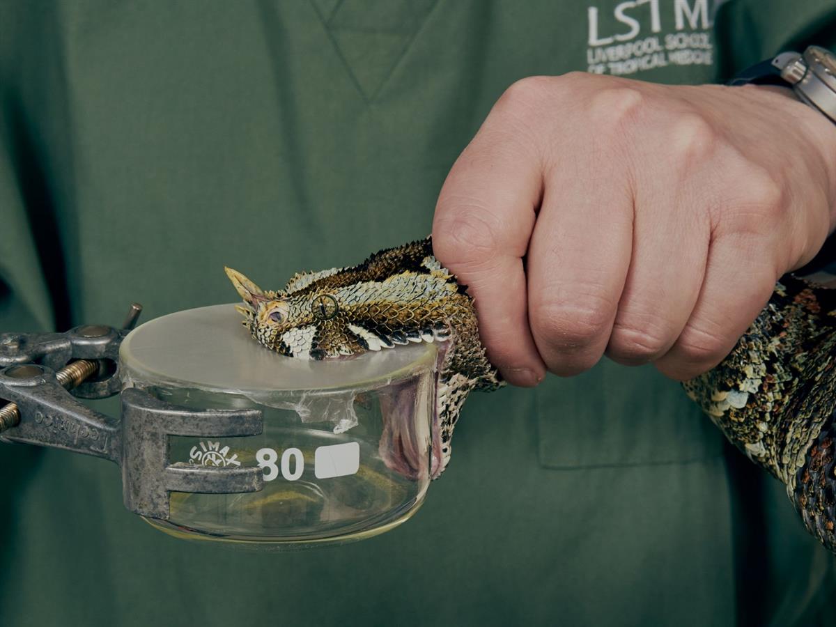 Improving treatment for snakebite patients