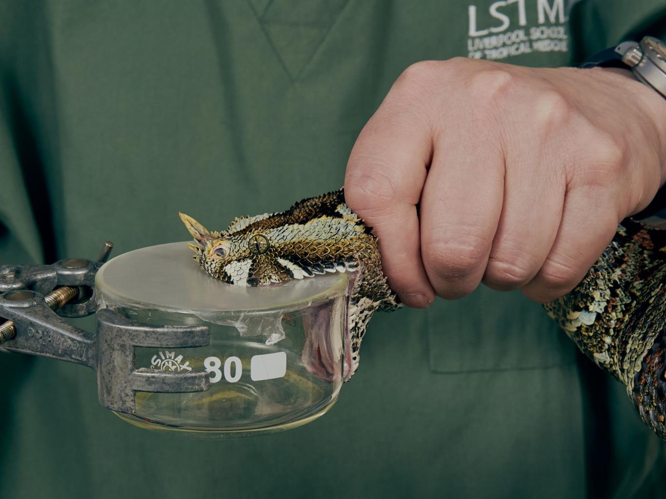 Improving treatment for snakebite patients