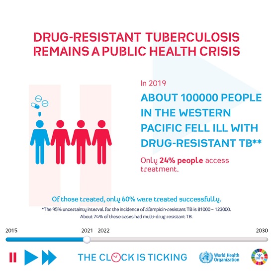 Tuberculosis